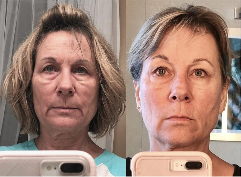 PrimaSkin | Lifestyle for Health
