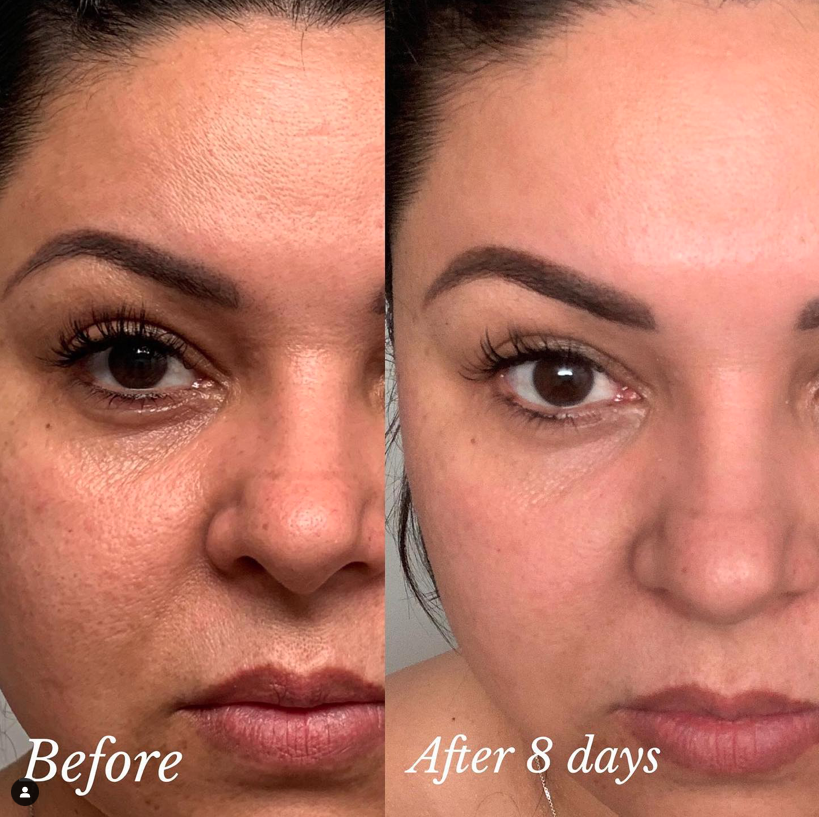 PrimaSkin | Lifestyle for Health